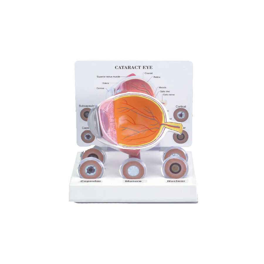 Cataract Eye Model