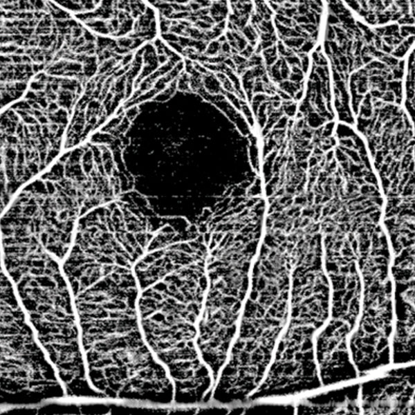 H Angio Module Angiography Module